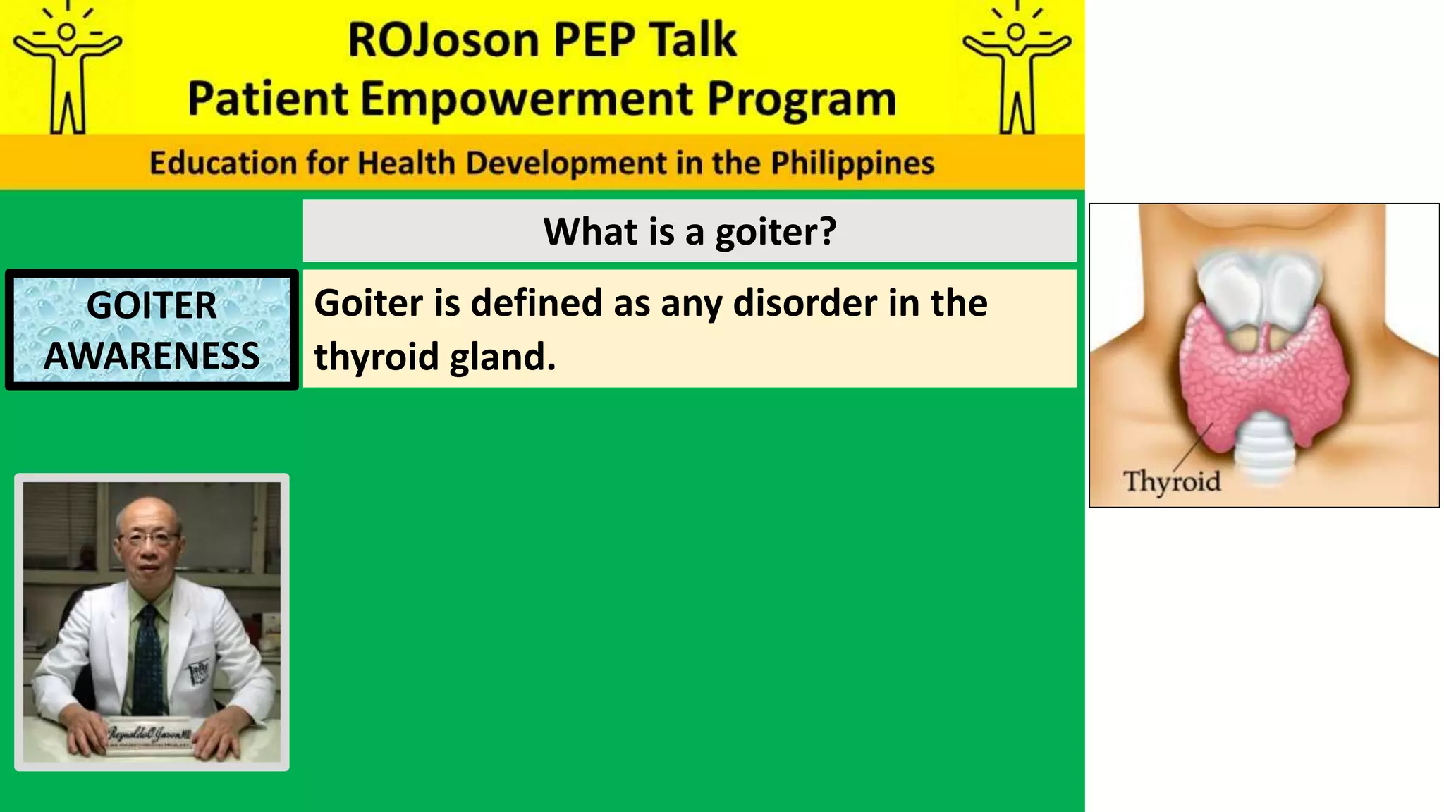 ROJoson PEP Talk: GOITER AWARENESS | PPTX