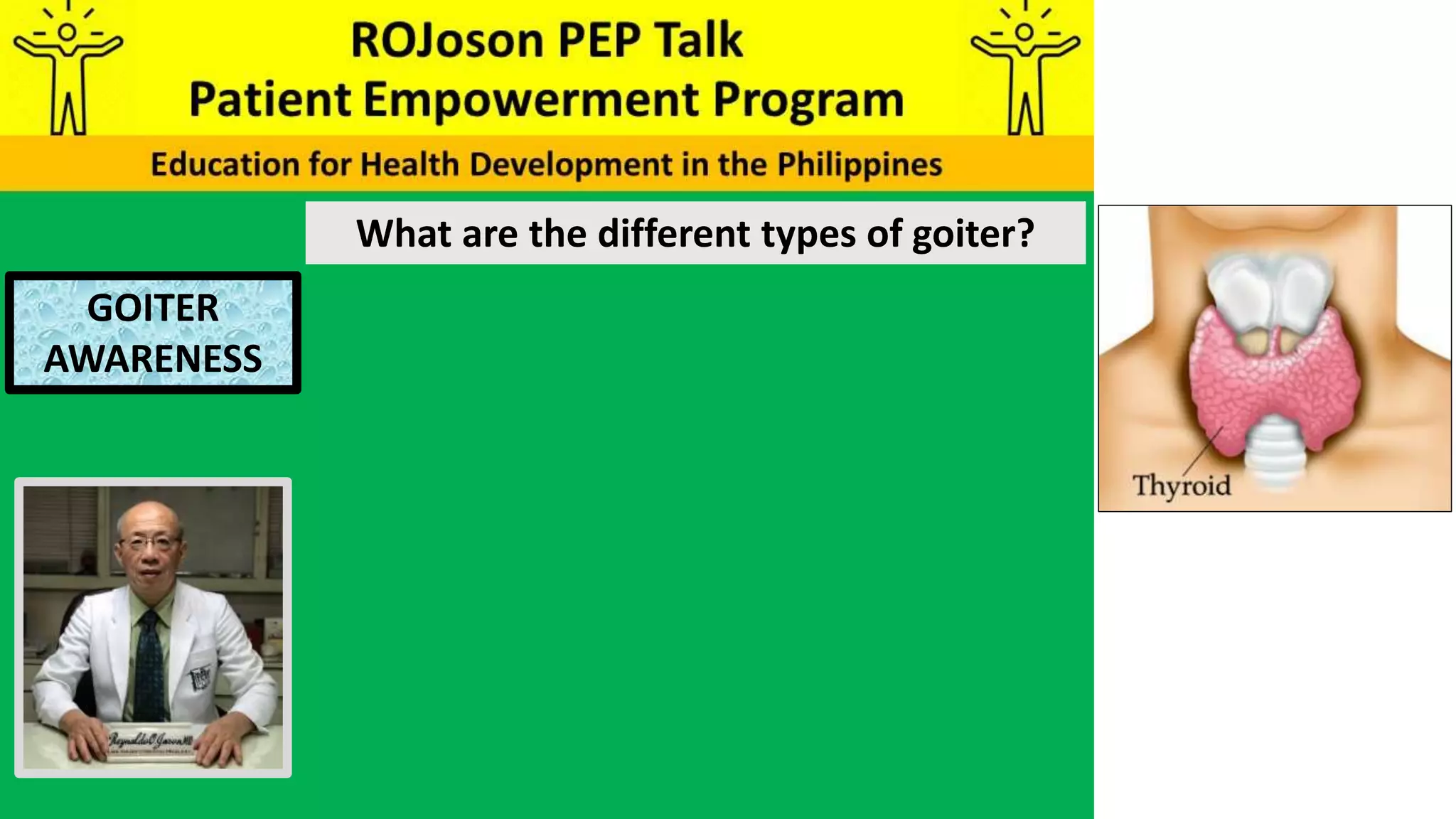 ROJoson PEP Talk: GOITER AWARENESS | PPTX