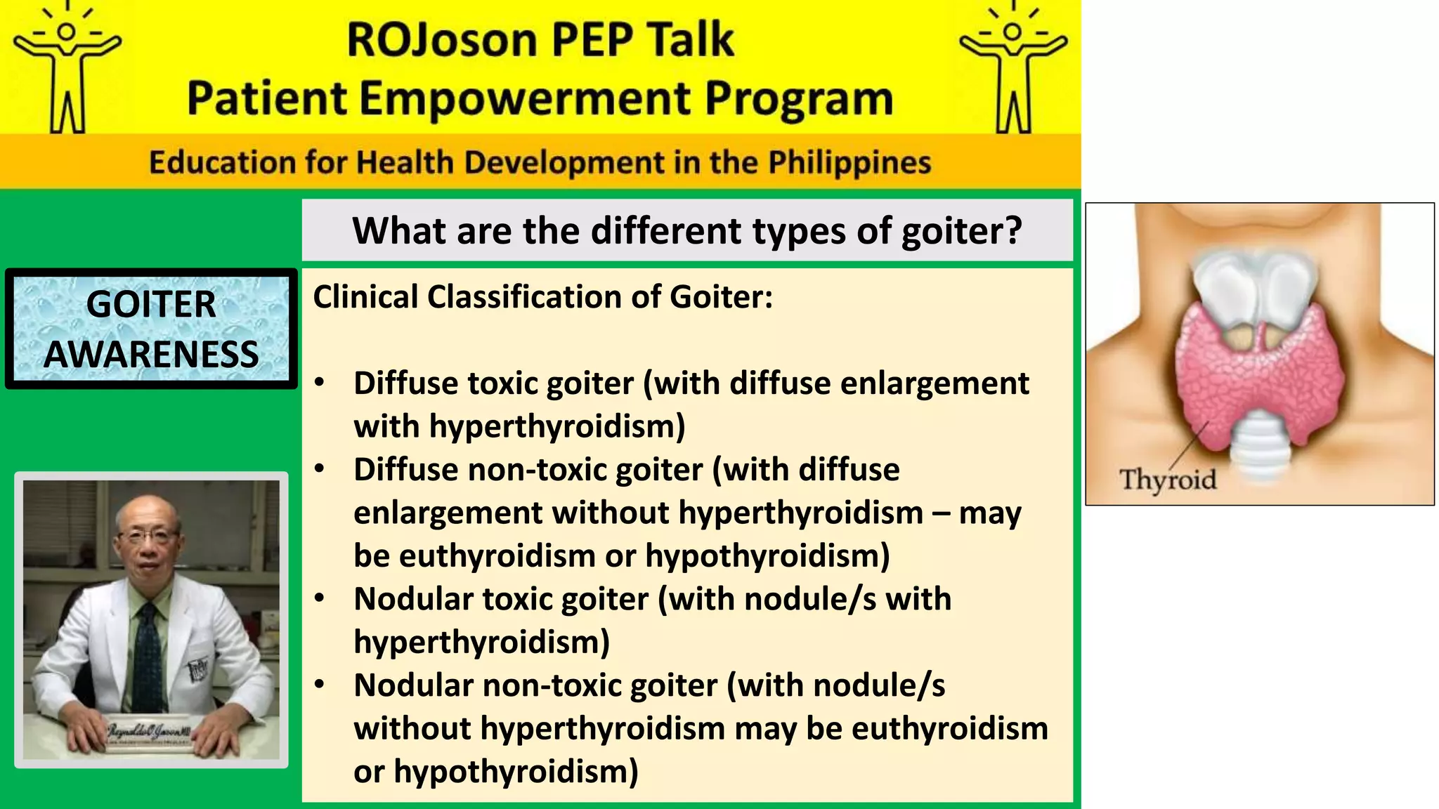 ROJoson PEP Talk: GOITER AWARENESS | PPTX