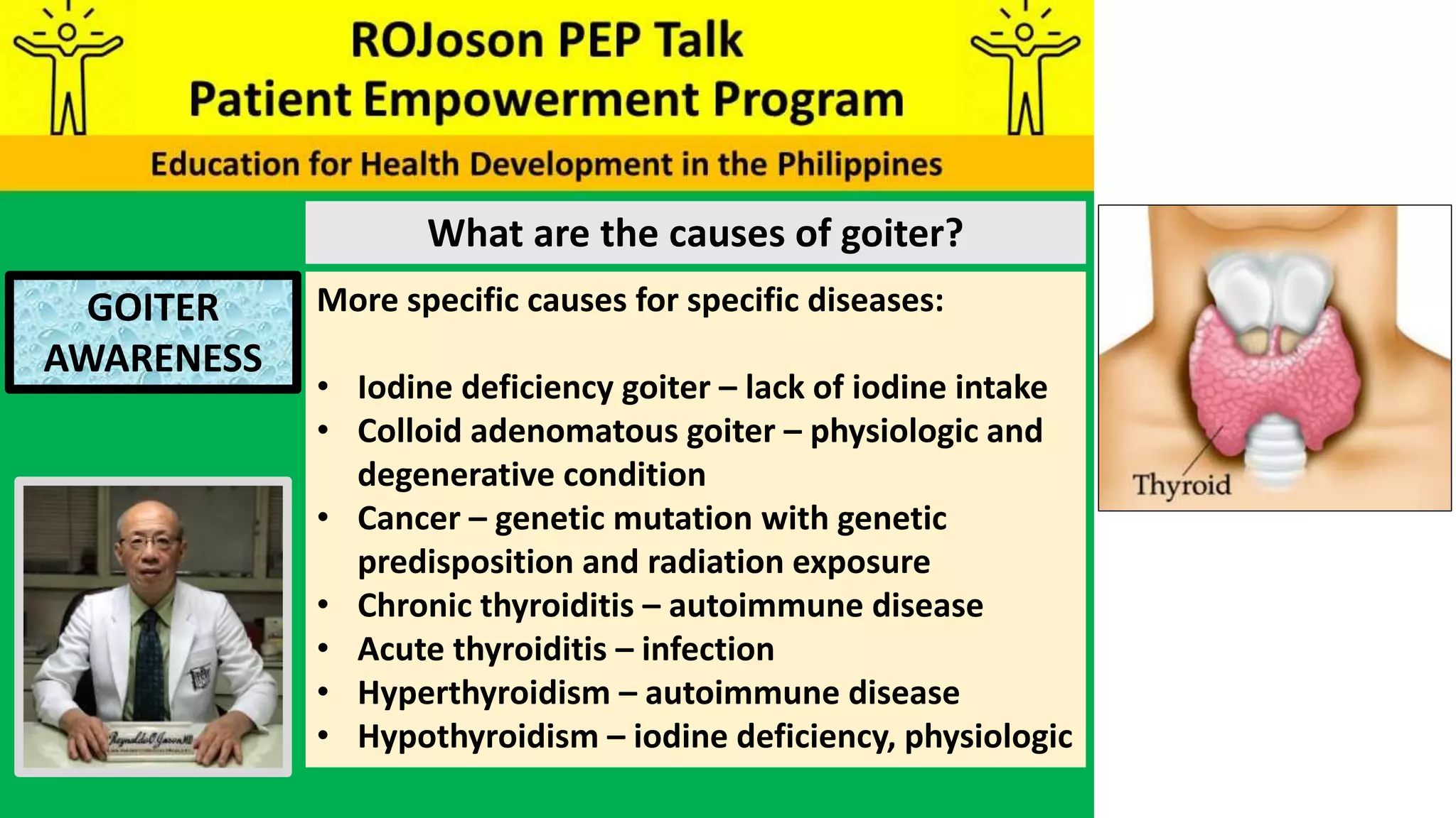 ROJoson PEP Talk: GOITER AWARENESS | PPTX