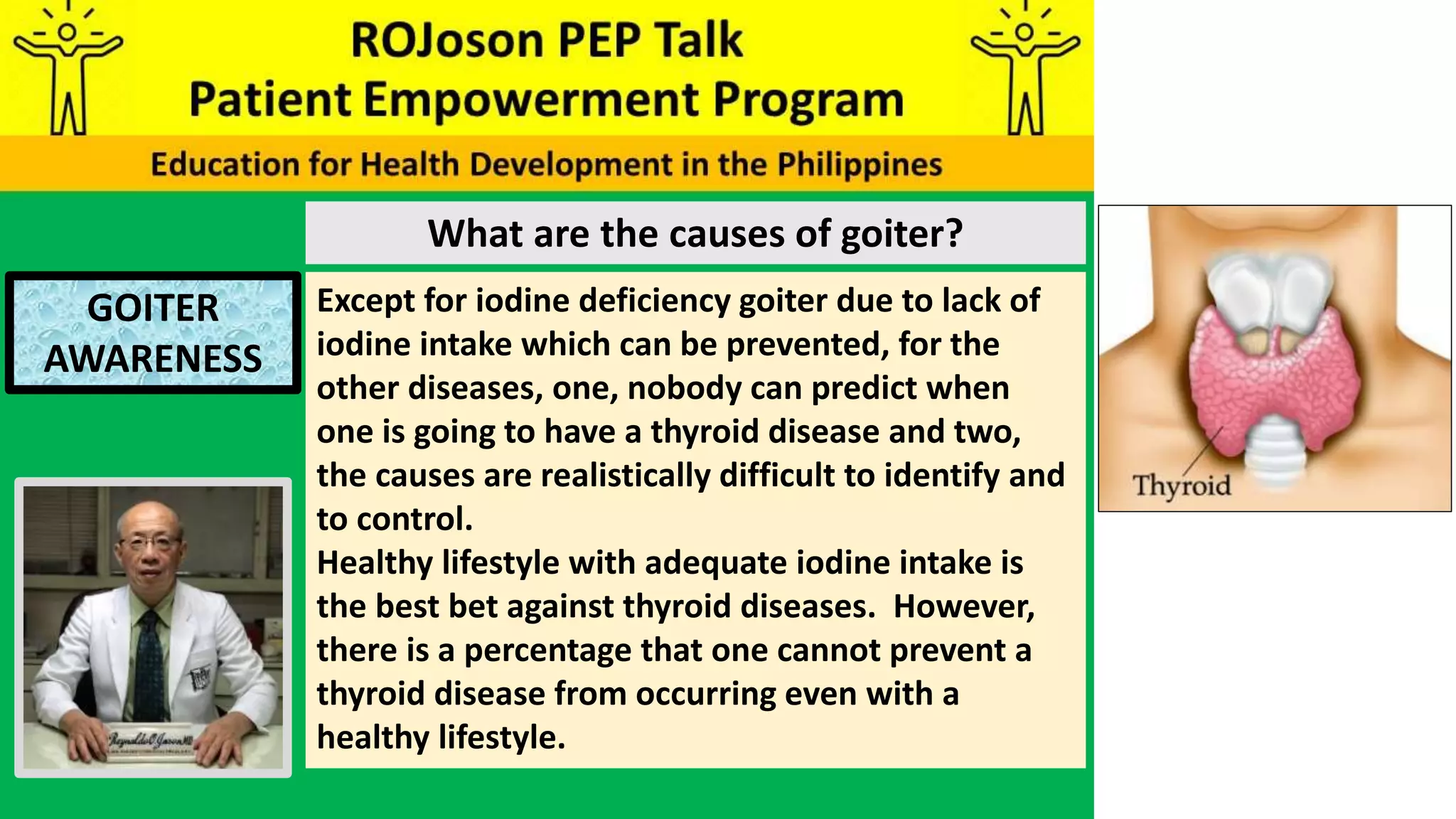 ROJoson PEP Talk: GOITER AWARENESS | PPTX