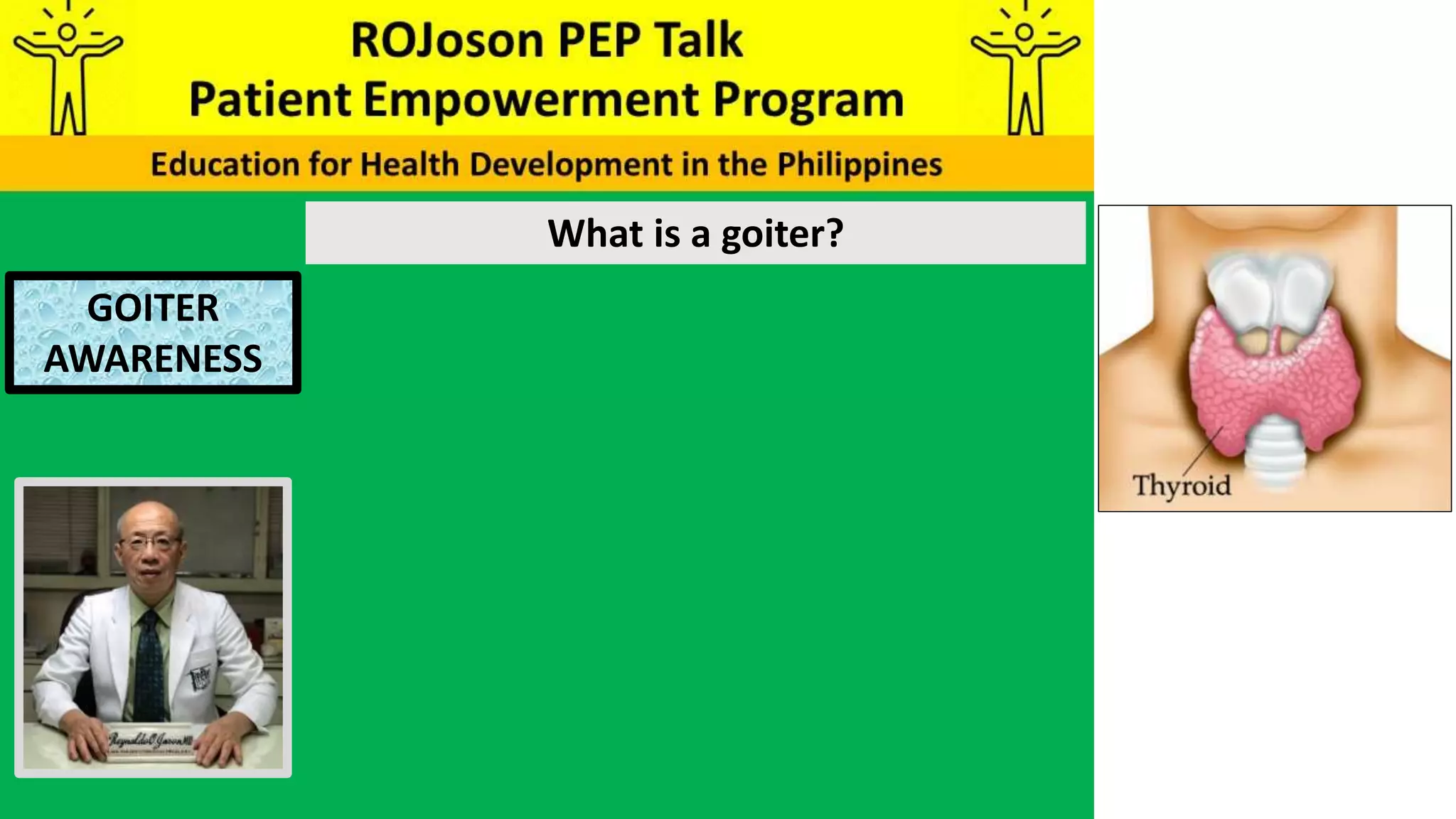 ROJoson PEP Talk: GOITER AWARENESS | PPTX
