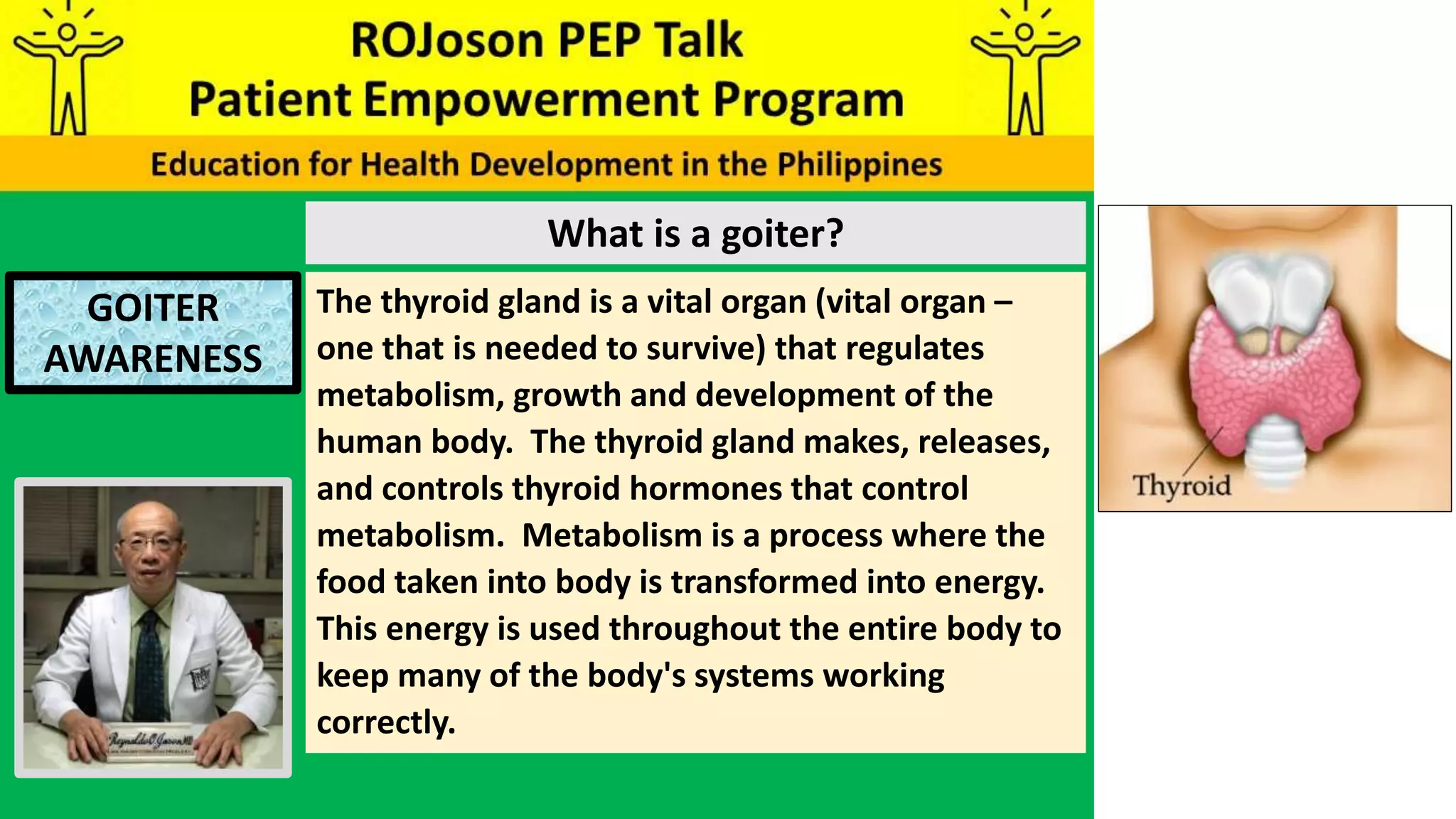 ROJoson PEP Talk: GOITER AWARENESS | PPTX