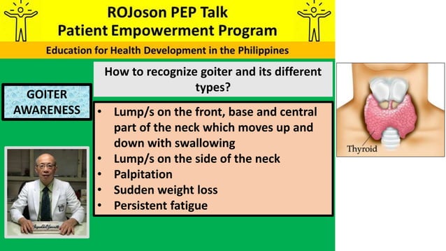 ROJoson PEP Talk: GOITER AWARENESS | PPTX | Thyroid Disorders ...