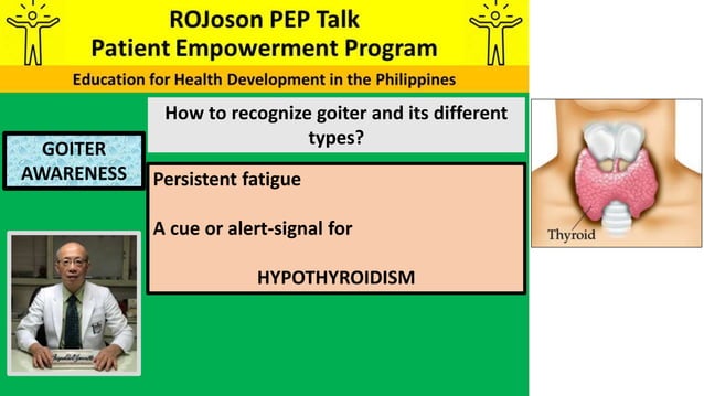 ROJoson PEP Talk: GOITER AWARENESS | PPTX | Thyroid Disorders ...