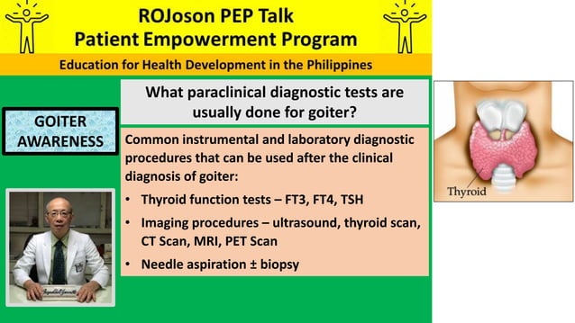 ROJoson PEP Talk: GOITER AWARENESS | PPTX | Thyroid Disorders ...