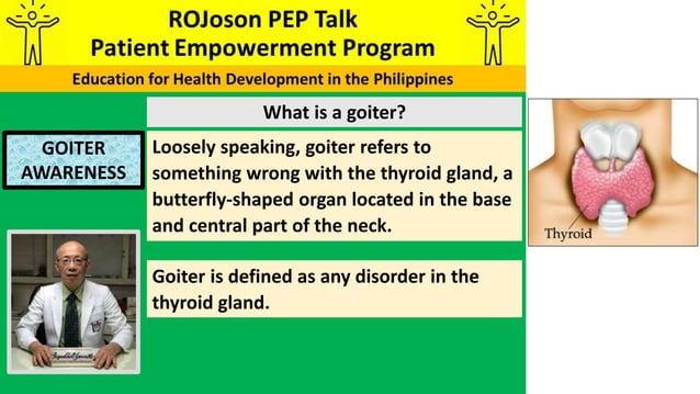 ROJoson PEP Talk: GOITER AWARENESS | PPTX | Thyroid Disorders ...