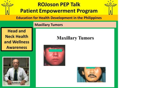 ROJoson PEP Talk: HEAD & NECK WELLNESS AWARENESS | PPTX