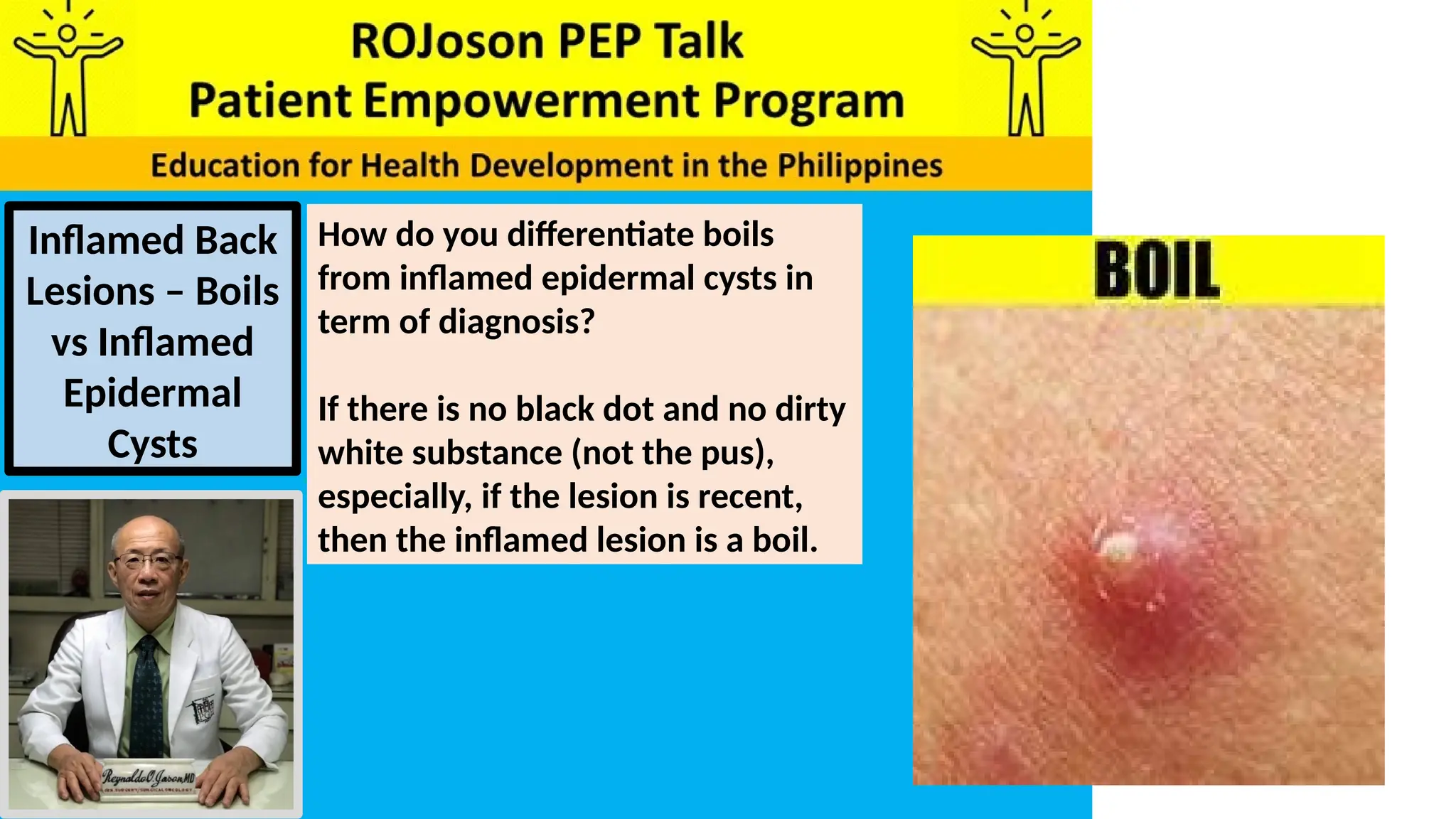ROJoson PEP Talk: Inflamed Back Lesions: Boils vs Inflamed Epidermal ...