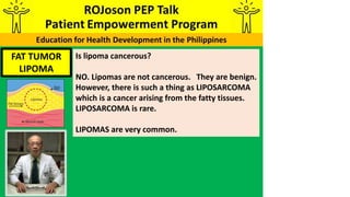 ROJoson PEP Talk: FAT TUMOR LIPOMA | PPT