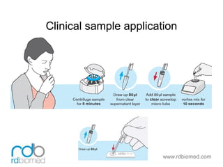 Peptest - Pepsin detection in digestive and respiratory fluids | PPSX