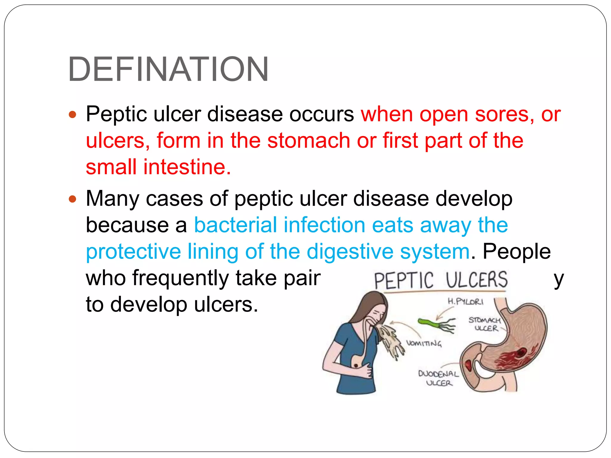 peptic ulcer disease.pptx