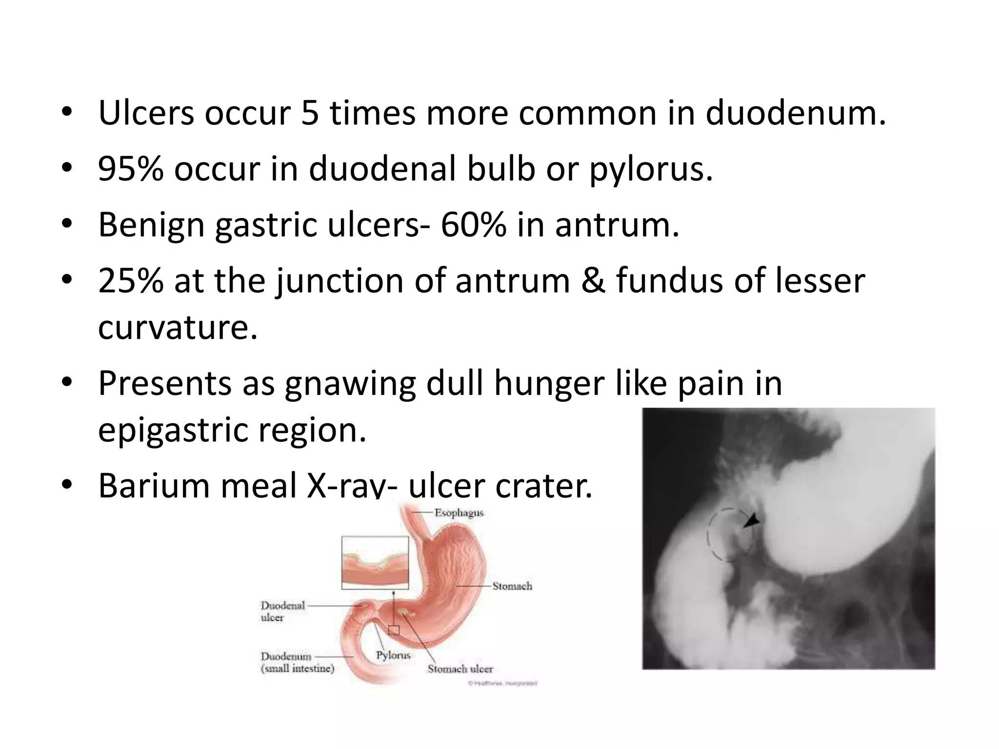 drugs for peptic ulcer | PPTX
