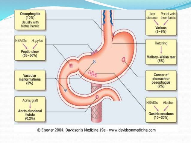 Diet For Partial Gastric Outlet Obstruction Causes - tanmediaget