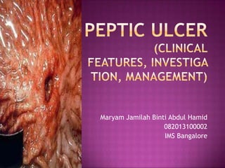 Peptic ulcer (Clinical features, Investigation and Management ...