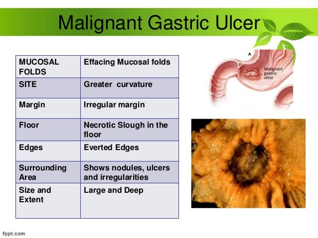 Peptic ulcer