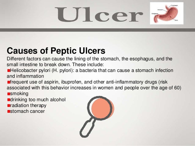 Peptic Ulcer