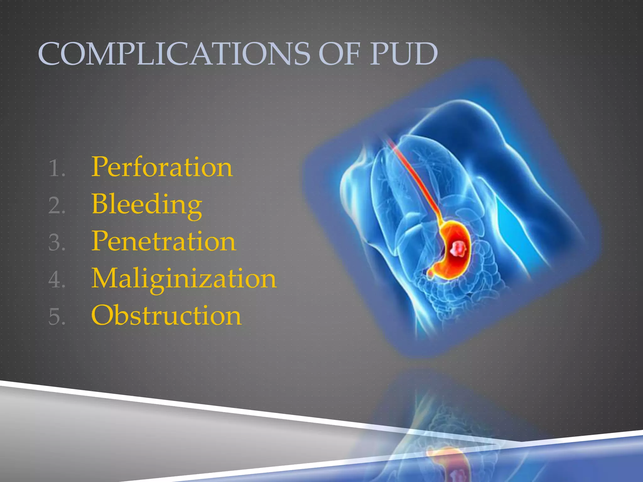 Peptic Ulcer Complications | PPTX
