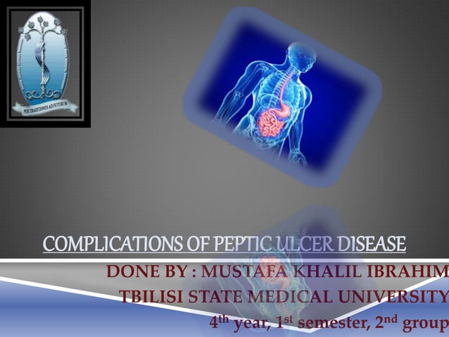 Peptic Ulcer Complications | PPTX | Digestive Disorders | Diseases and ...