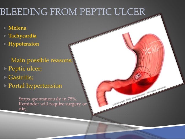 Peptic Ulcer Complications