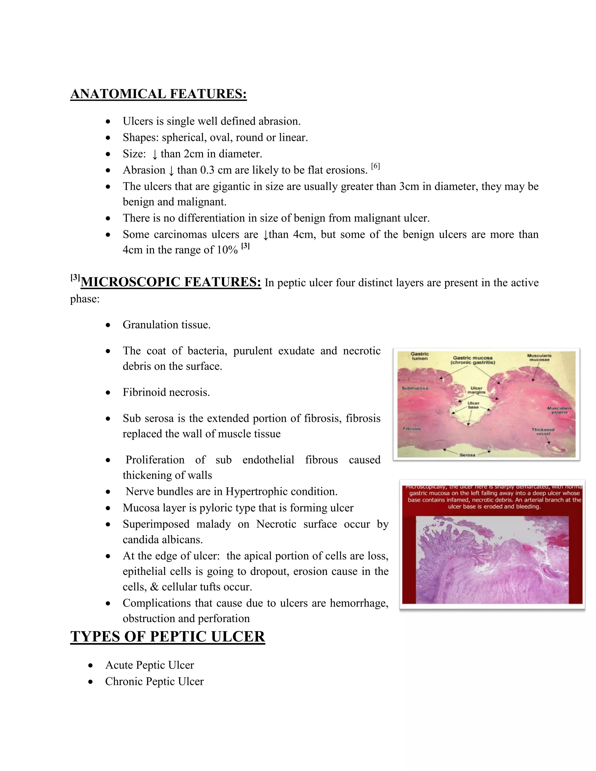 Peptic ulcer | PDF