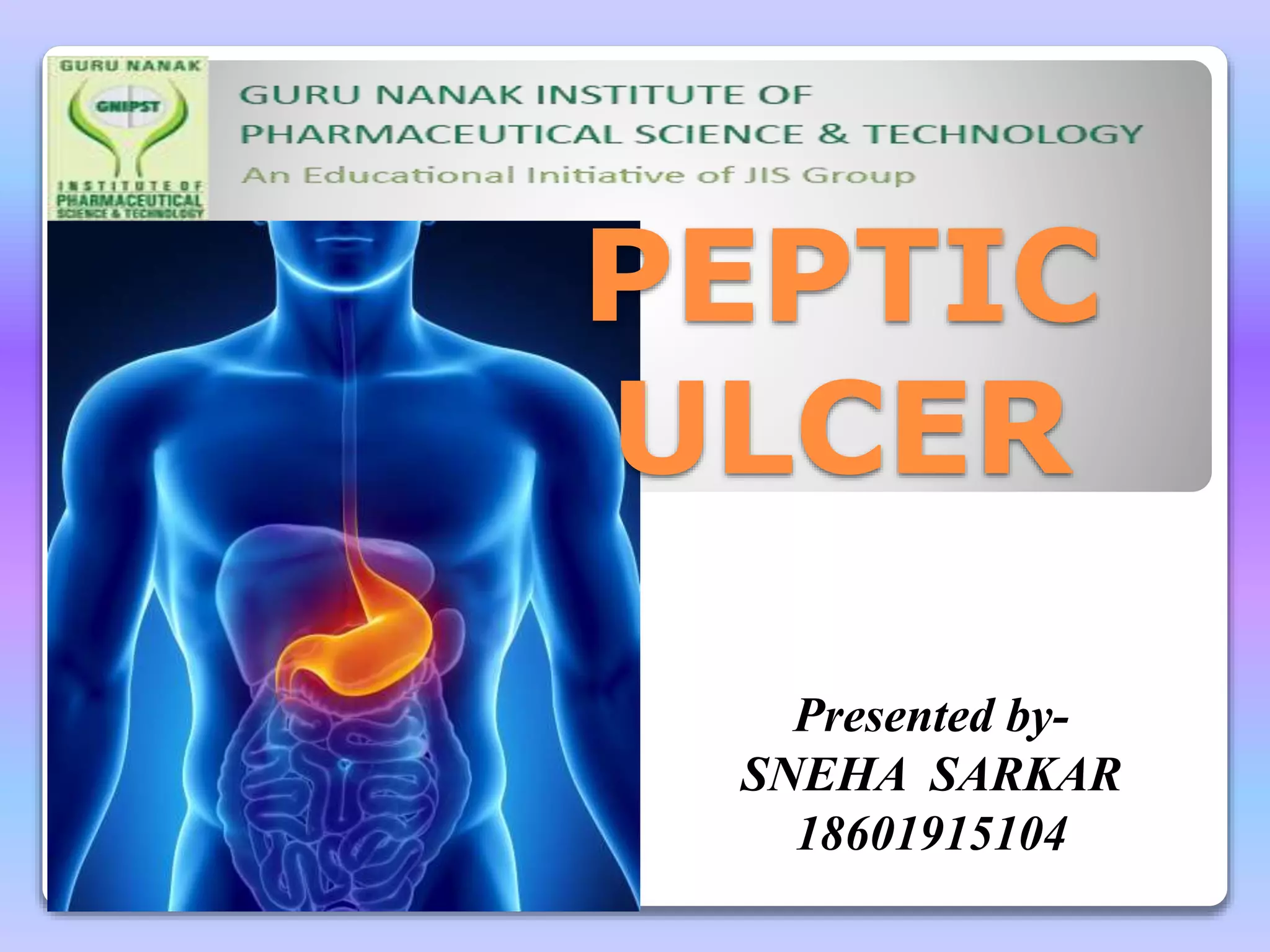 Peptic ulcer | PPT