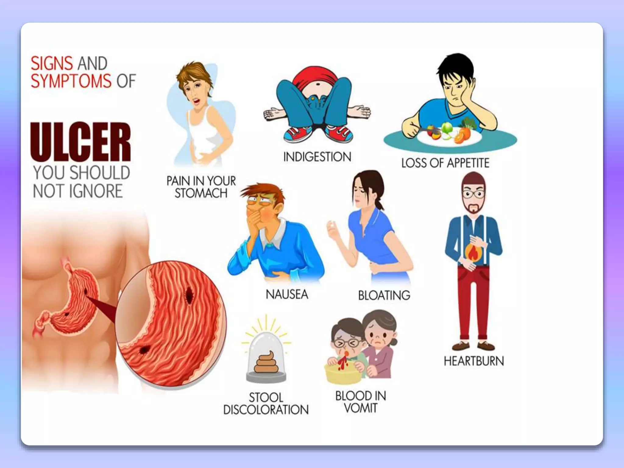 Peptic ulcer | PPT