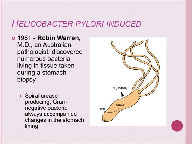 pathophysiology of peptic ulcers | PPT