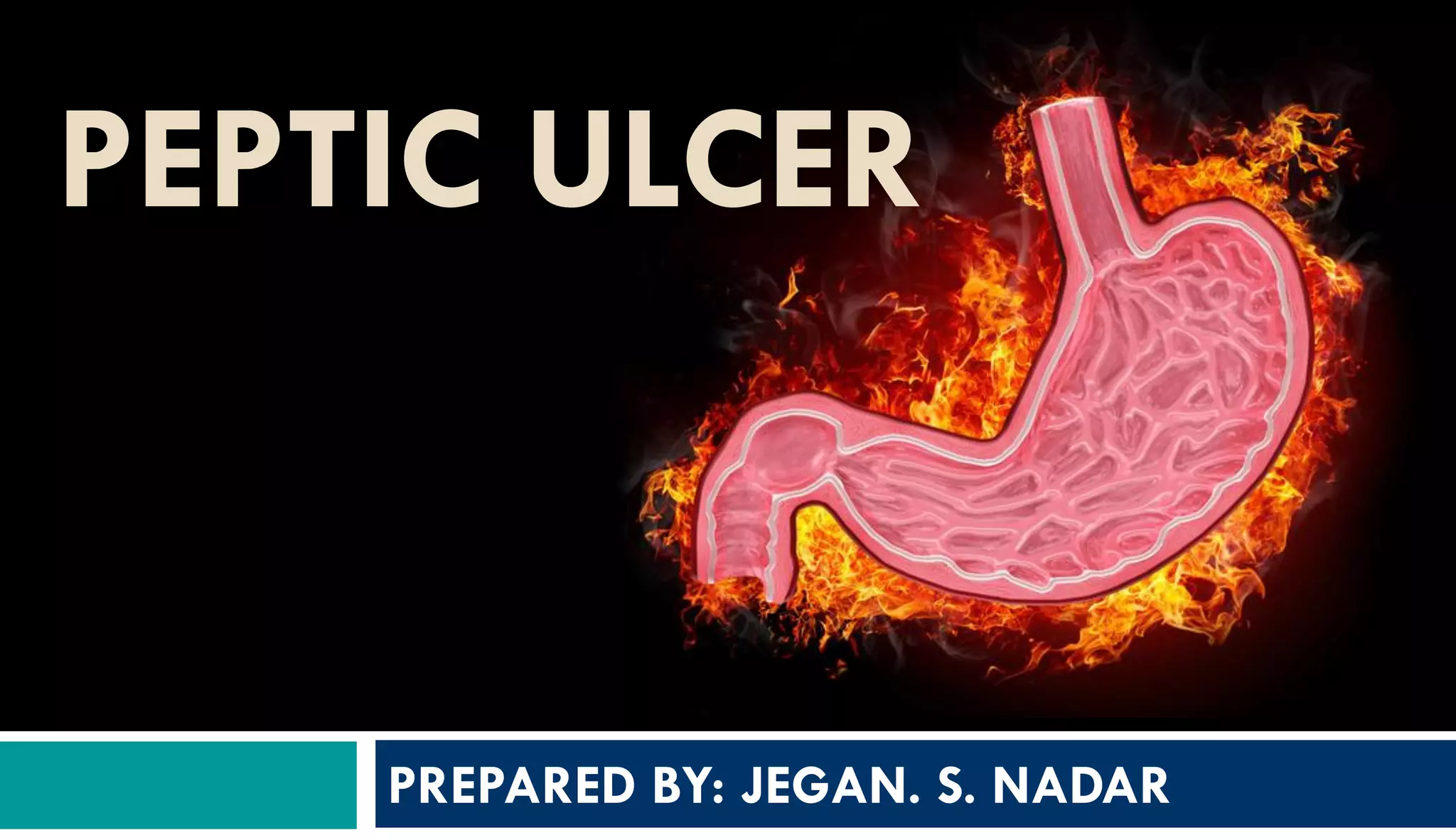 Pathophysiology of Peptic ulcer | PDF