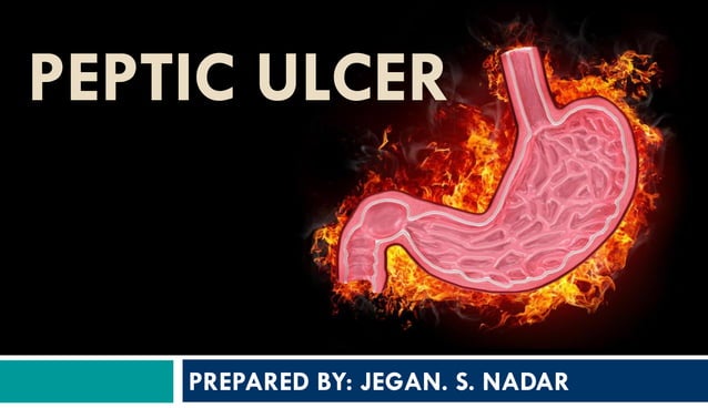Pathophysiology of Peptic ulcer | PDF