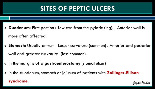 Pathophysiology of Peptic ulcer | PDF