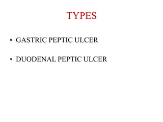 Pepticulcer | PPT