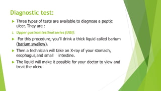 Peptic ulcer | PPT