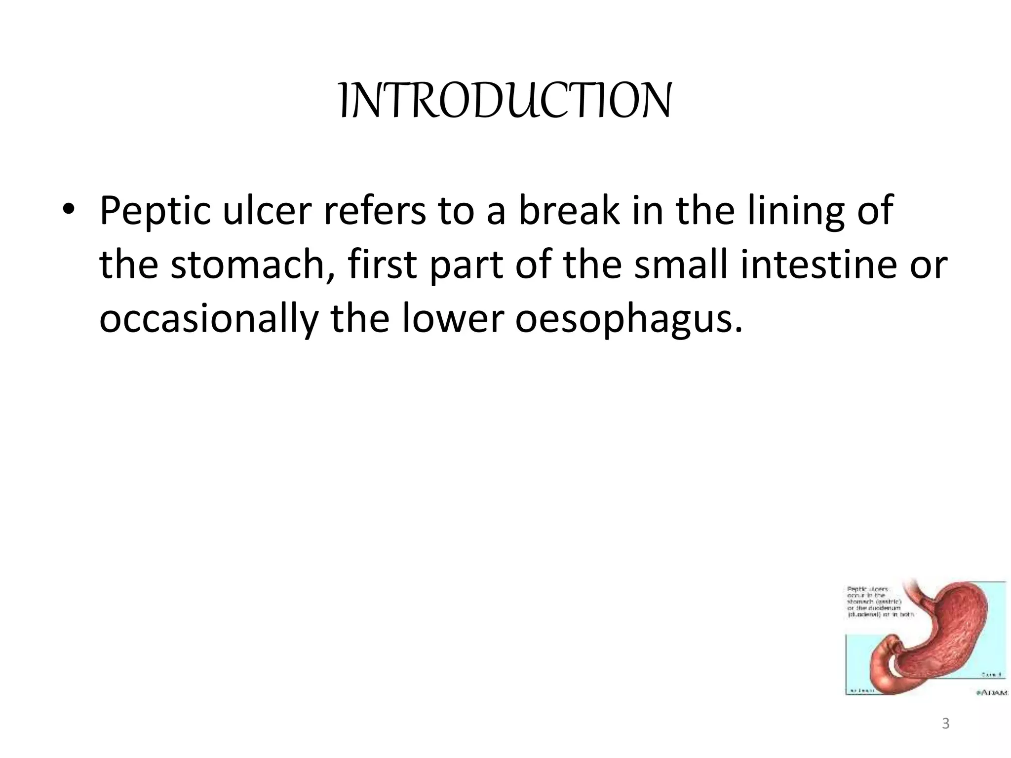 Peptic ulcer | PPT