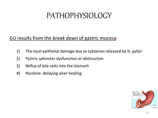 Peptic ulcer | PPTX