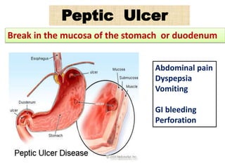 Drugs for Peptic ulcer | PPT
