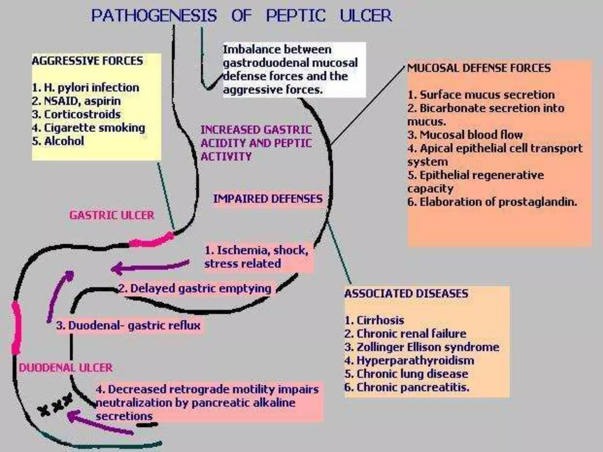 PEPTIC ULCER.ppt | Digestive Disorders | Diseases and Conditions