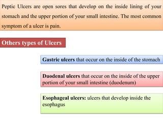 PEPTIC ULCER.ppt