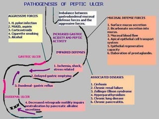 PEPTIC ULCER.ppt