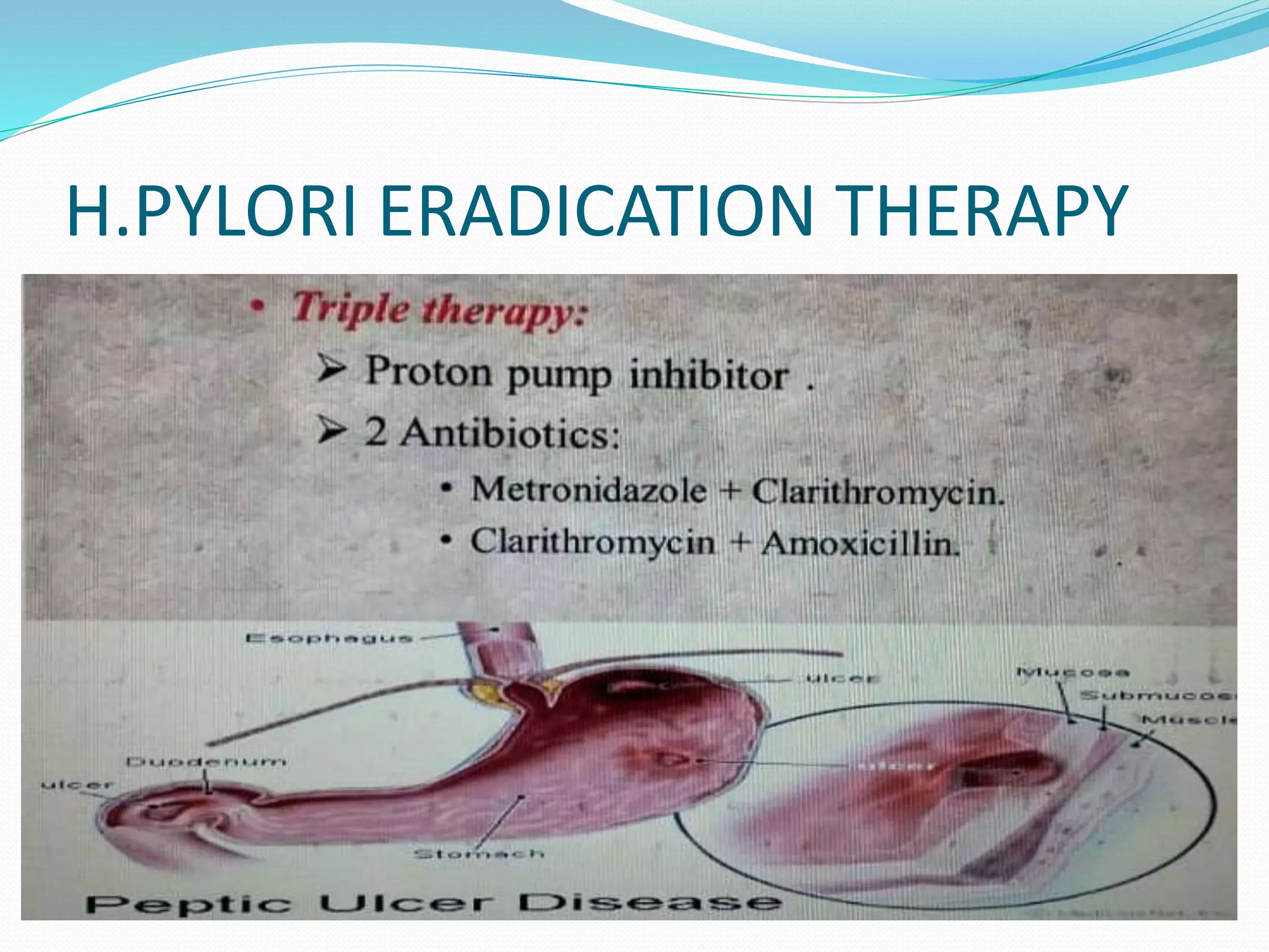 PEPTIC ULCER.pptx | Digestive Disorders | Diseases and Conditions