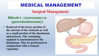 PEPTIC ULCER.pptx