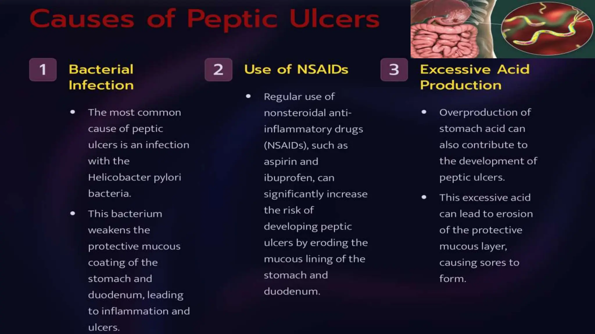 peptic ulcer(gastric, duodenal stress ulcers ppts | PPTX