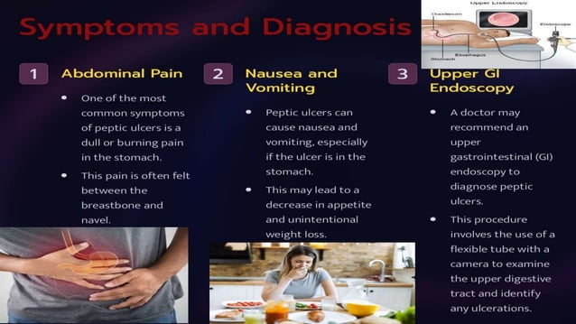 peptic ulcer(gastric, duodenal stress ulcers ppts | PPTX