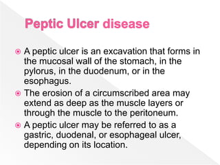 peptic ulcer advance concepts of nursing.pptx