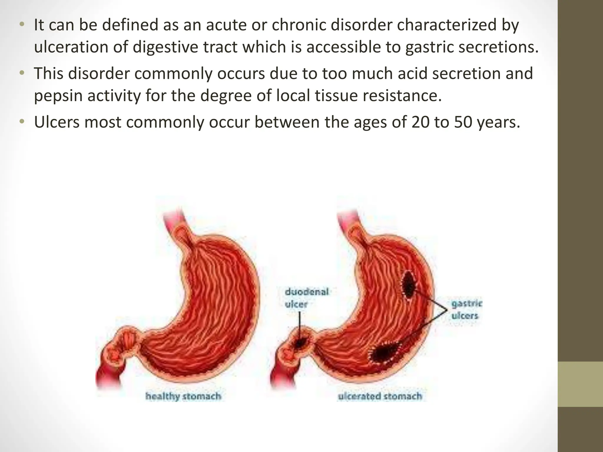 PEPTIC ULCER signs and symptoms and medicines | PPT