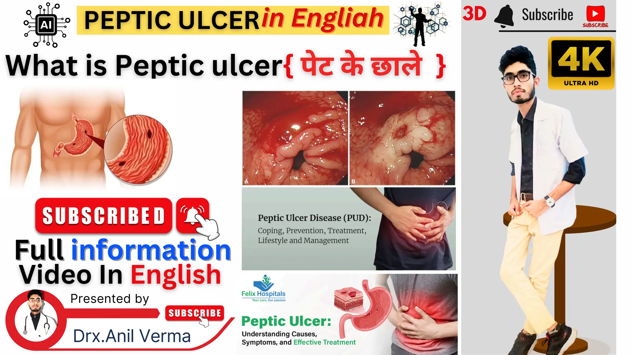 Peptic Ulcer treatment symptoms and privention | PDF | Digestive ...