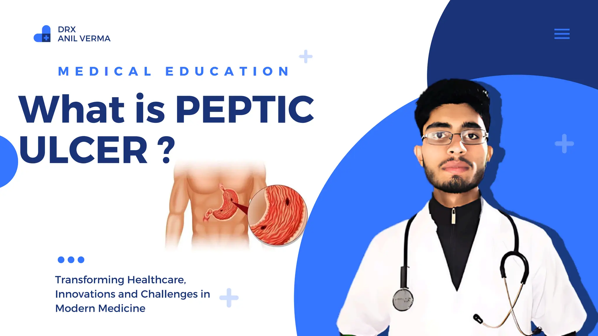 Peptic Ulcer treatment symptoms and privention | PDF | Digestive ...