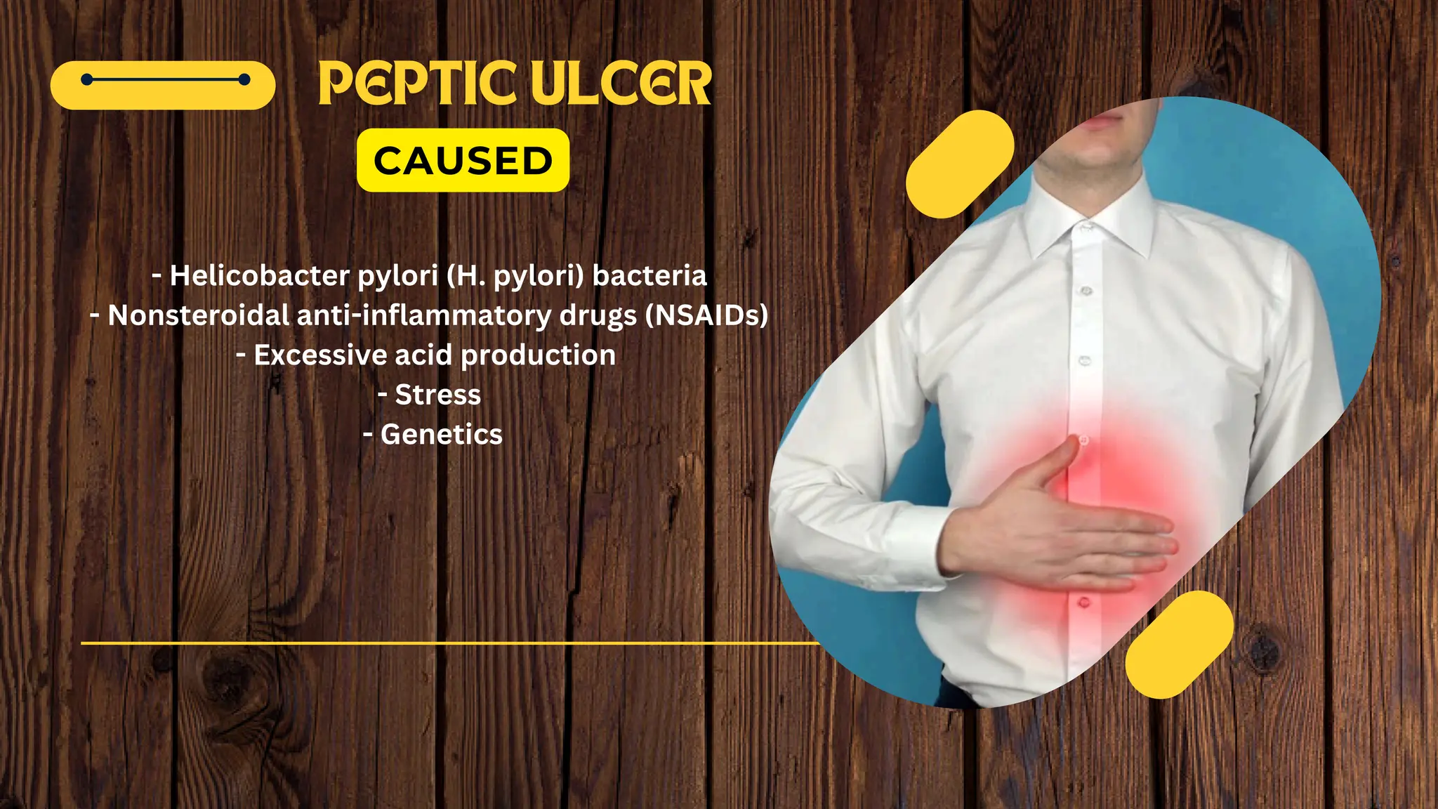 Peptic Ulcer treatment symptoms and privention | PDF | Digestive ...
