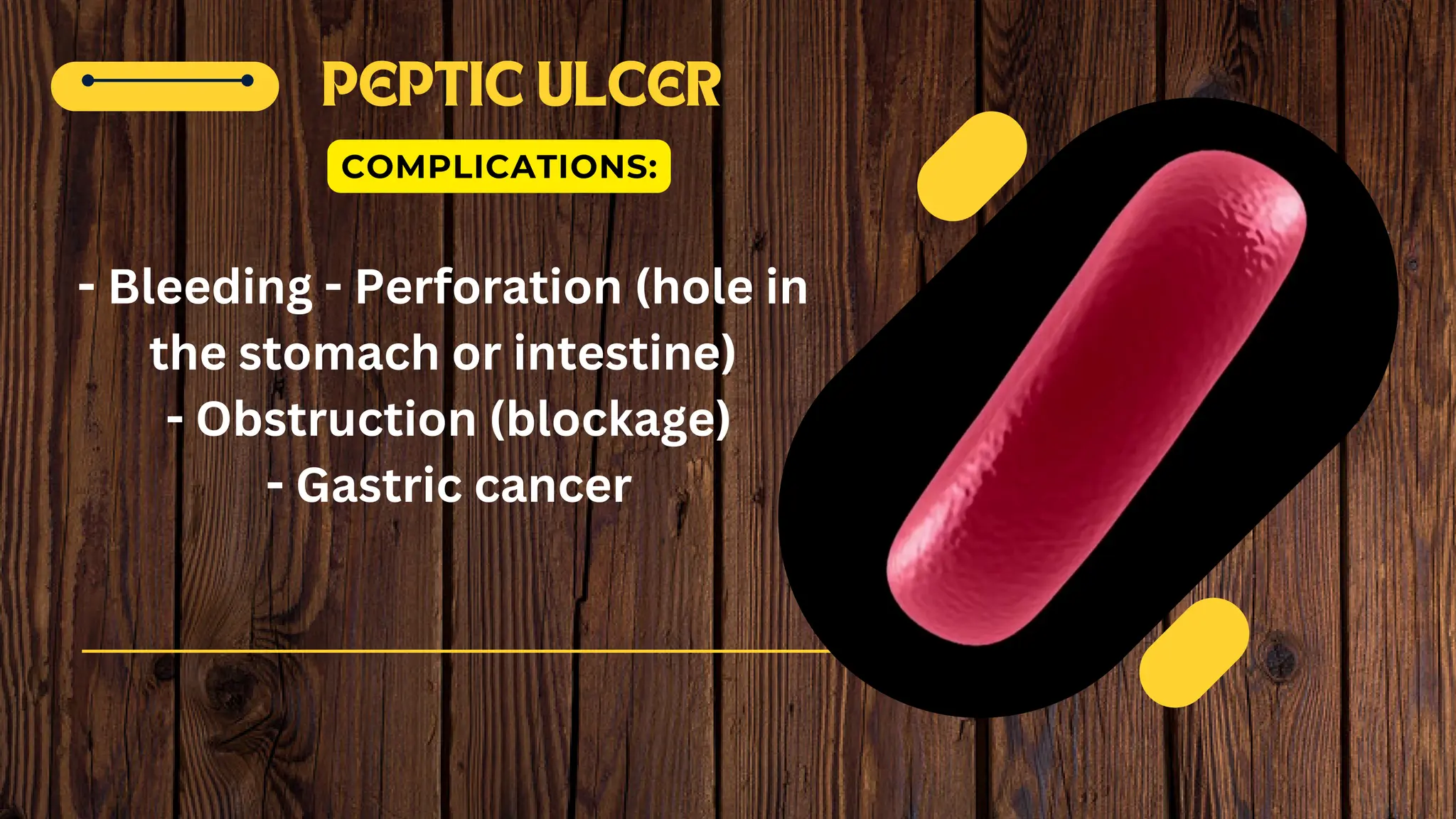 Peptic Ulcer treatment symptoms and privention | PDF | Digestive ...