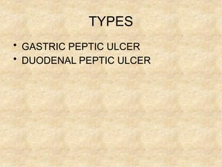 pepticyulcerulceroepticupepticulcer.pptx